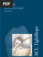 Syndesmosis Tightrope XP Implant System: Surgical Technique | PDF ...