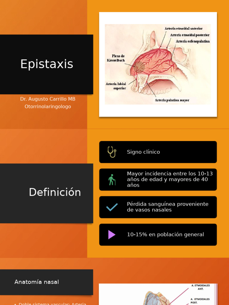 Epistaxis | PDF | Artería | Otorrinolaringología