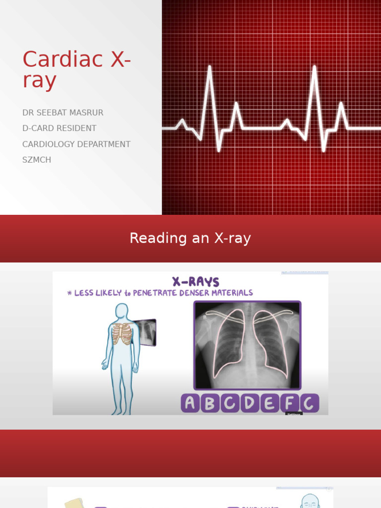 Cardiac X-Ray Interpretation Guide | PDF | Heart | Aorta