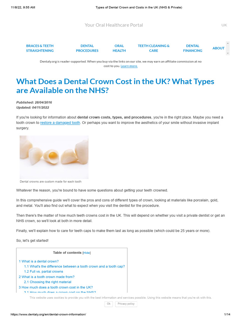 NHS Dental Crown Costs and Options | PDF | Dentistry | Dental Implant