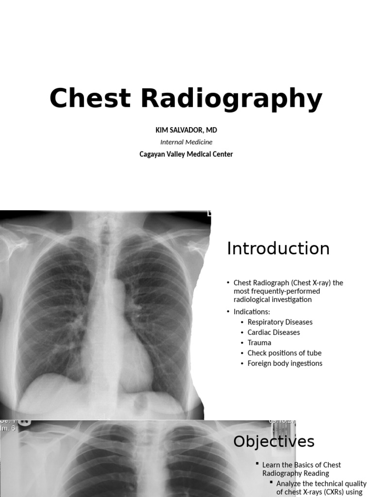 Chest Radiography | PDF | Lung | Medical Specialties
