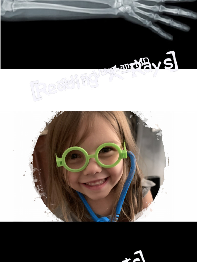 MSK X-Ray Lecture Slides | PDF