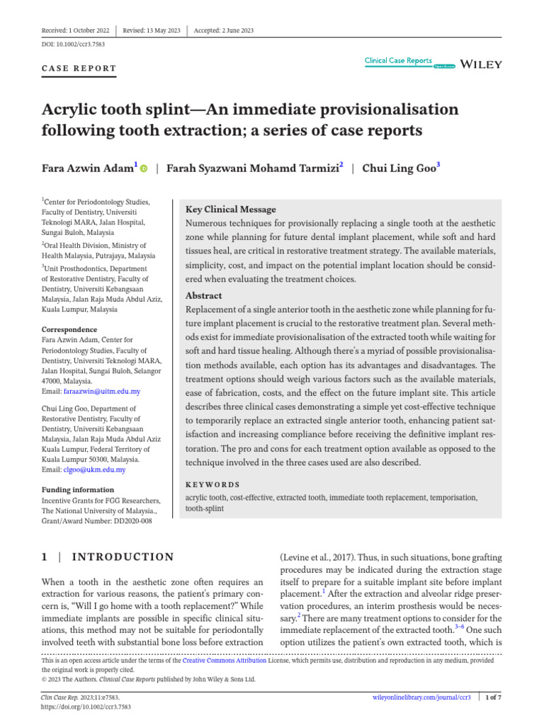 Acrylic Tooth Splint-An Immediate Provisionalisati | PDF | Dental ...
