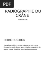 Examen Radiologique du Gril Costal | PDF | Thorax | Système squelettique