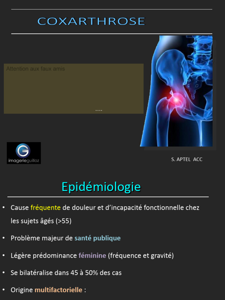 Coxarthrose : Diagnostic et Imagerie | PDF | Appareil locomoteur ...