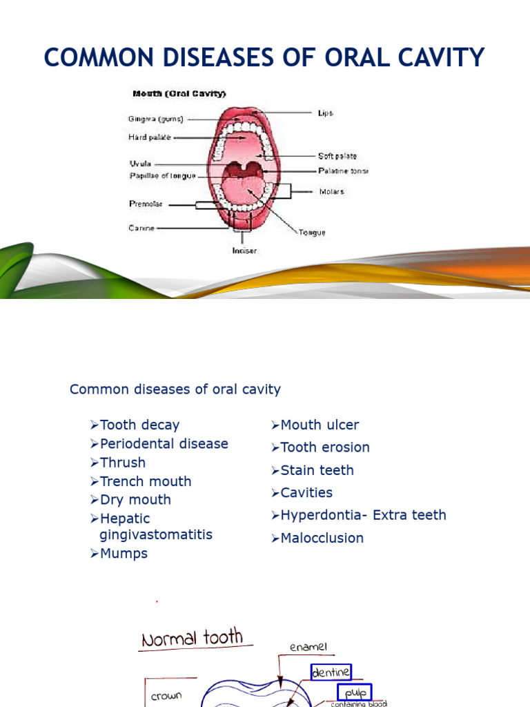 Common Oral Cavity Diseases Explained | PDF | Human Tooth | Periodontology