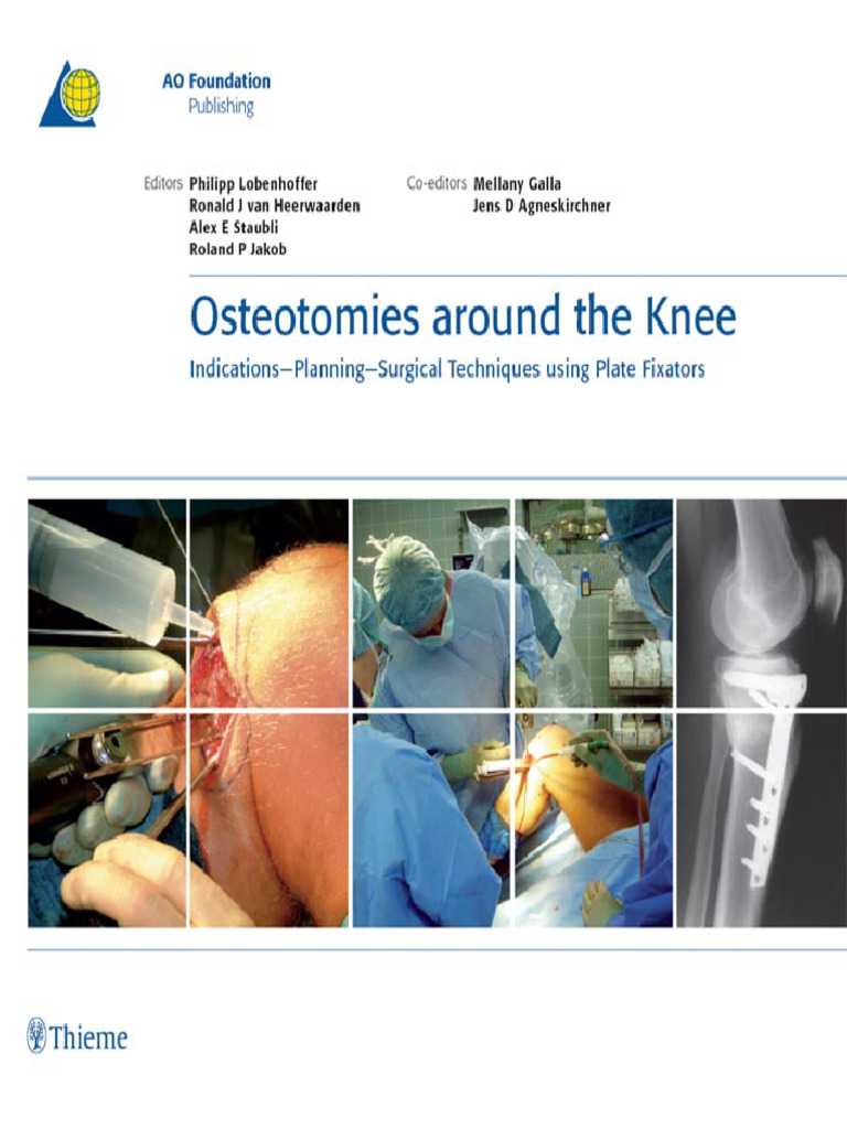 AO Osteotomies Around The Knee Indications Planning Surgical Techniques ...