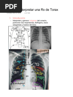 Radiología de Tórax - Patrones Básicos | PDF | Pulmón | Pecho