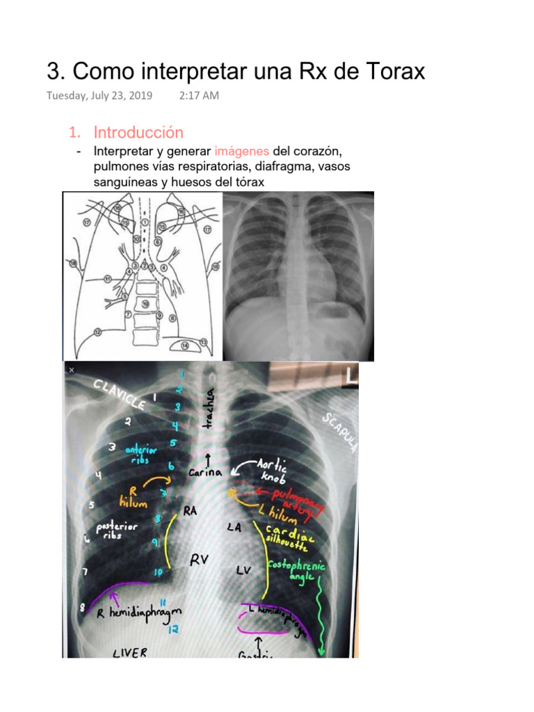 Interpretación de Rx de Tórax y Cicatrices | PDF | Pulmón | Tórax