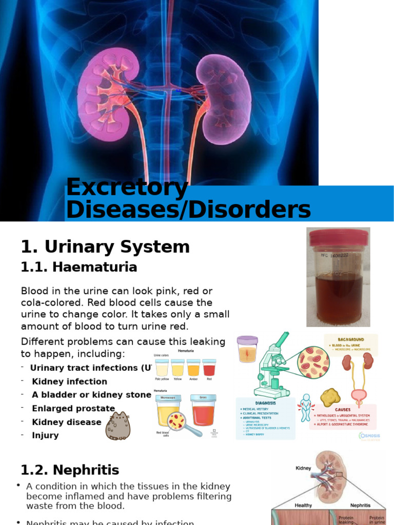 2. Excretory System - Diseases | PDF | Kidney | Urological Conditions