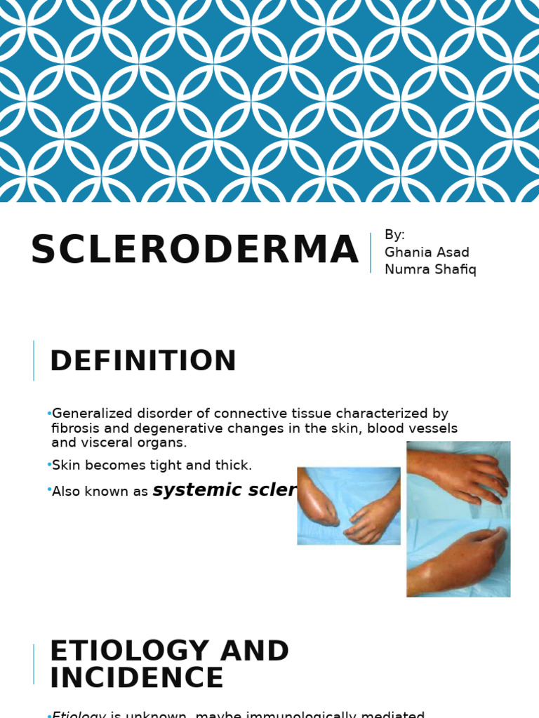 Scleroderma | PDF | Cutaneous Conditions | Clinical Medicine