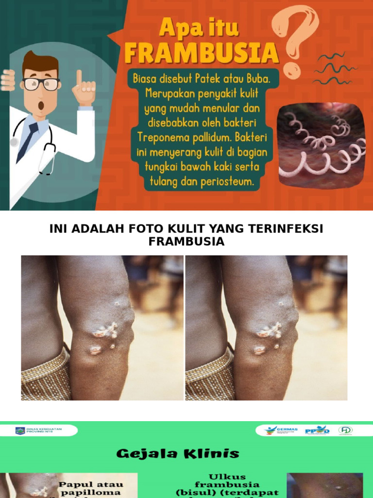 EDUKASI QR FRAMBUSIA | PDF