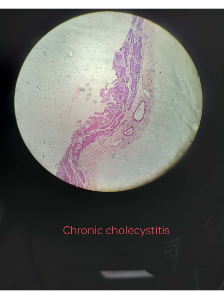 Pathology Slides | PDF