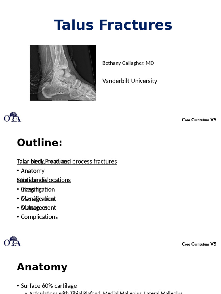 Talus Fractures: Vanderbilt University | PDF | Ankle | Skeletal System