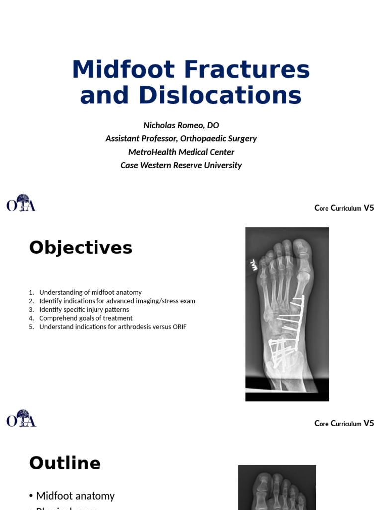 Midfoot Fractures and Dislocations Guide | PDF | Foot | Musculoskeletal ...