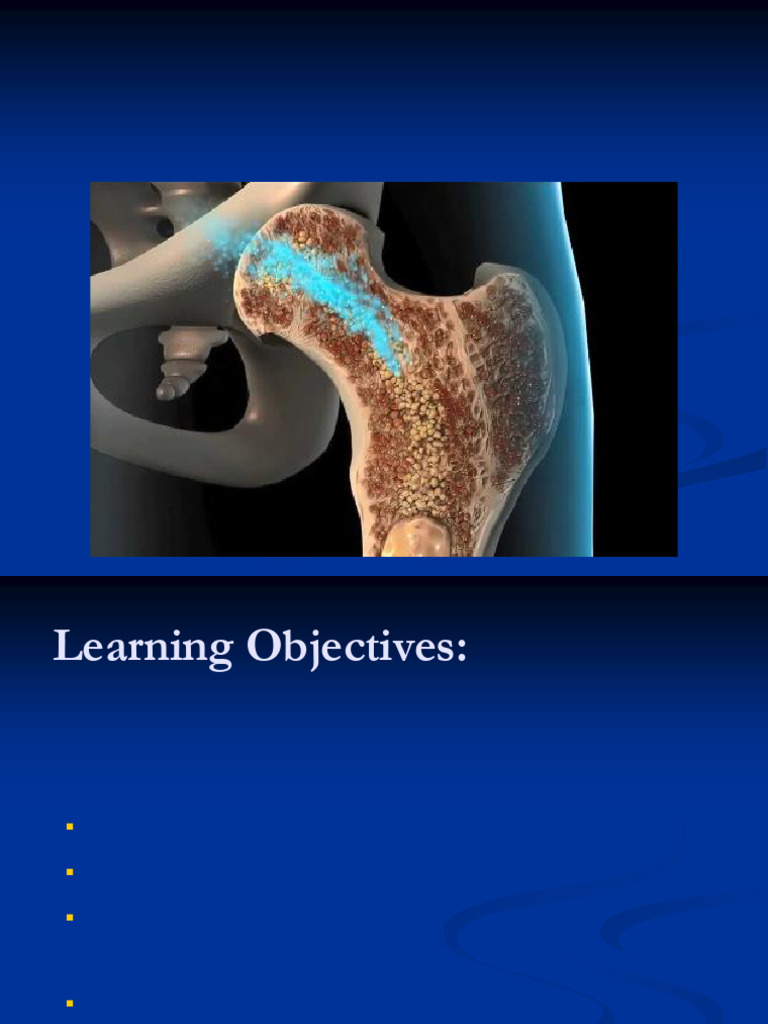 Bone Demineralization | PDF | Bone | Rheumatoid Arthritis