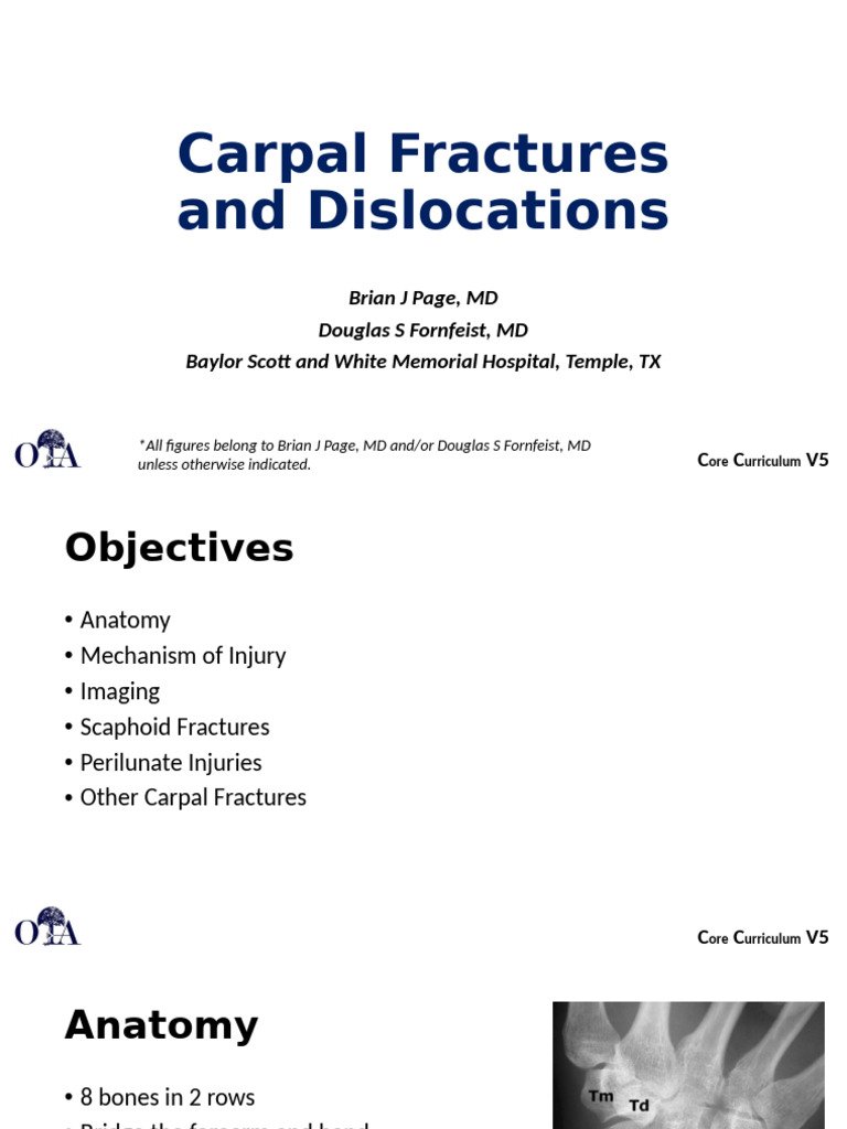 Carpal Fractures and Dislocations | PDF | Hand | Musculoskeletal System
