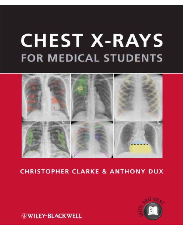 Chest Xrays For Medical Students | PDF