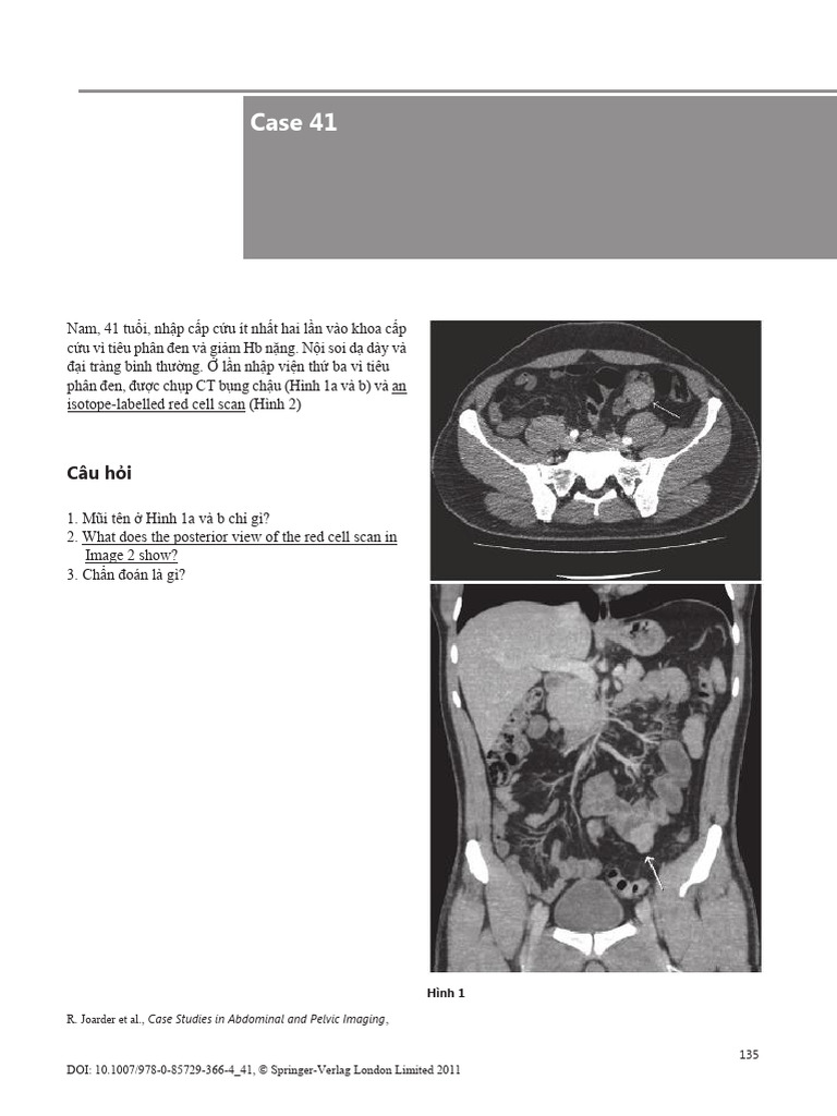 Bai-dich-100-case-bung-41-50-cdhainfo | PDF