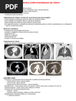 Aula - Protocolo - TC de Tórax | PDF | Átrio (coração) | Pulmão