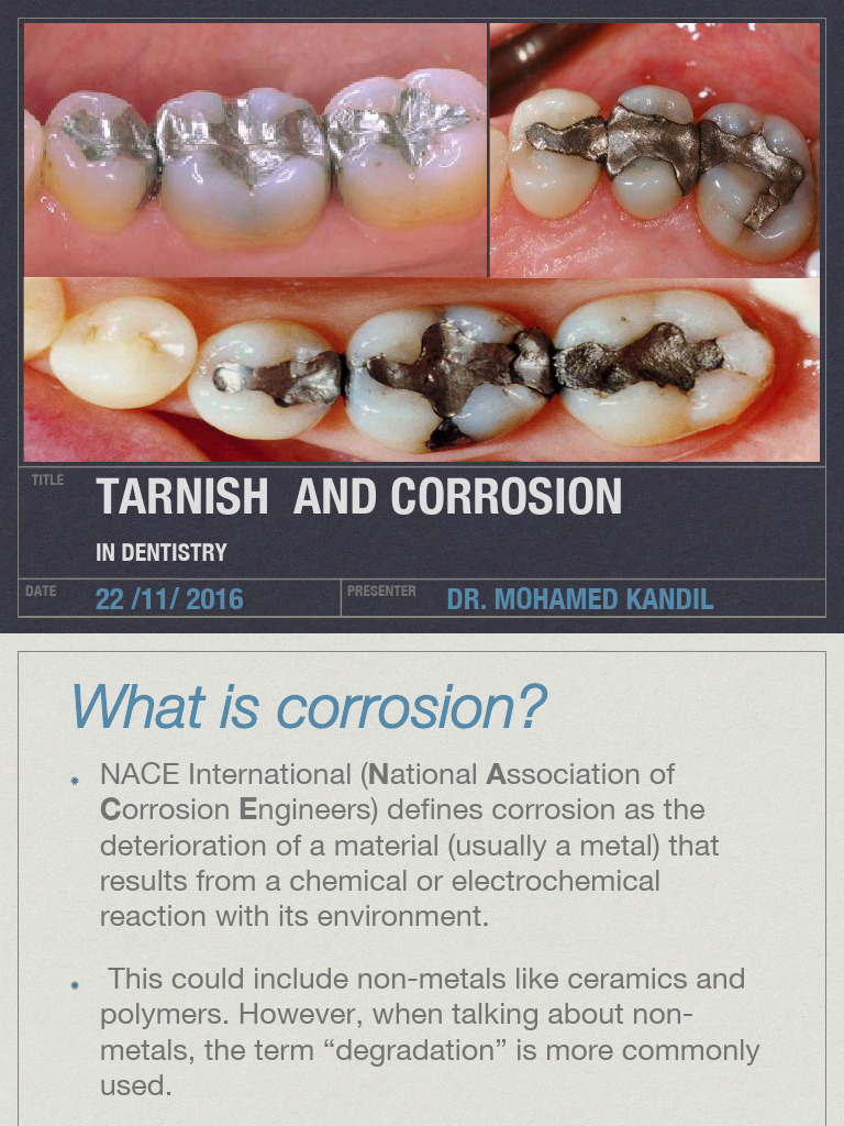 02- Tarnish and corrosion | PDF | Corrosion | Fracture