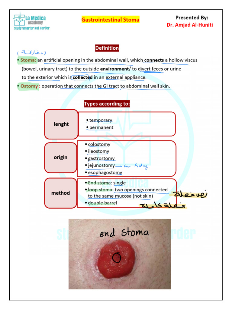 Understanding Gastrointestinal Stomas | PDF | Gastrointestinal Tract ...