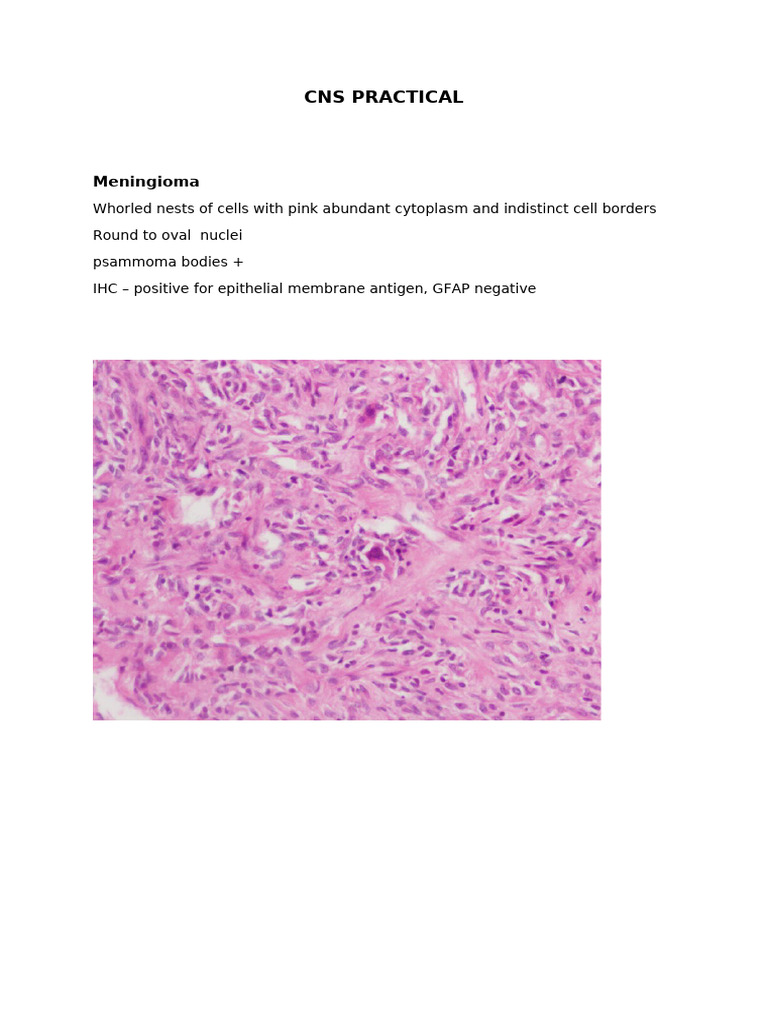 CNS Tumor Pathology Overview | PDF
