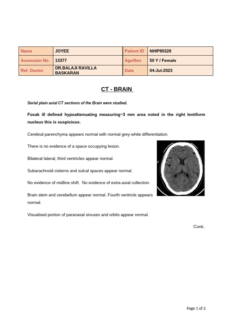 CT - Brain: Joyee NHIP80328 13377 50 Y / Female DR - Balaji Ravilla Baskaran 04-Jul-2023 | PDF