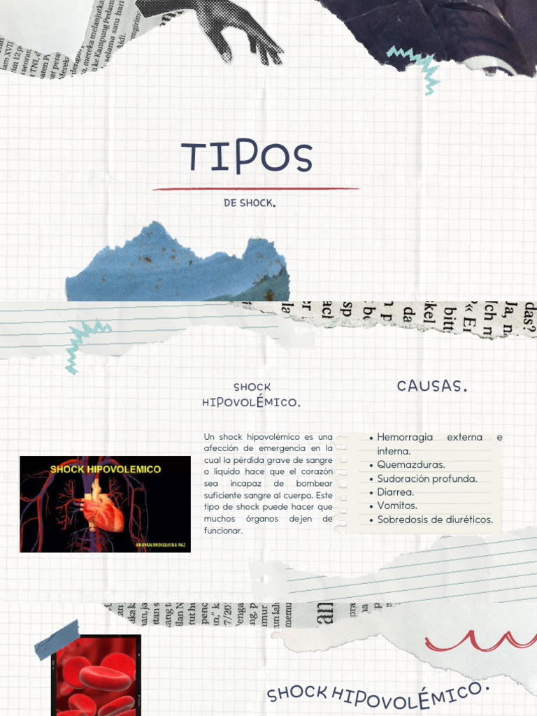 Tipos de Shock: Definición y Síntomas | PDF | Fisiología | Enfermedades ...