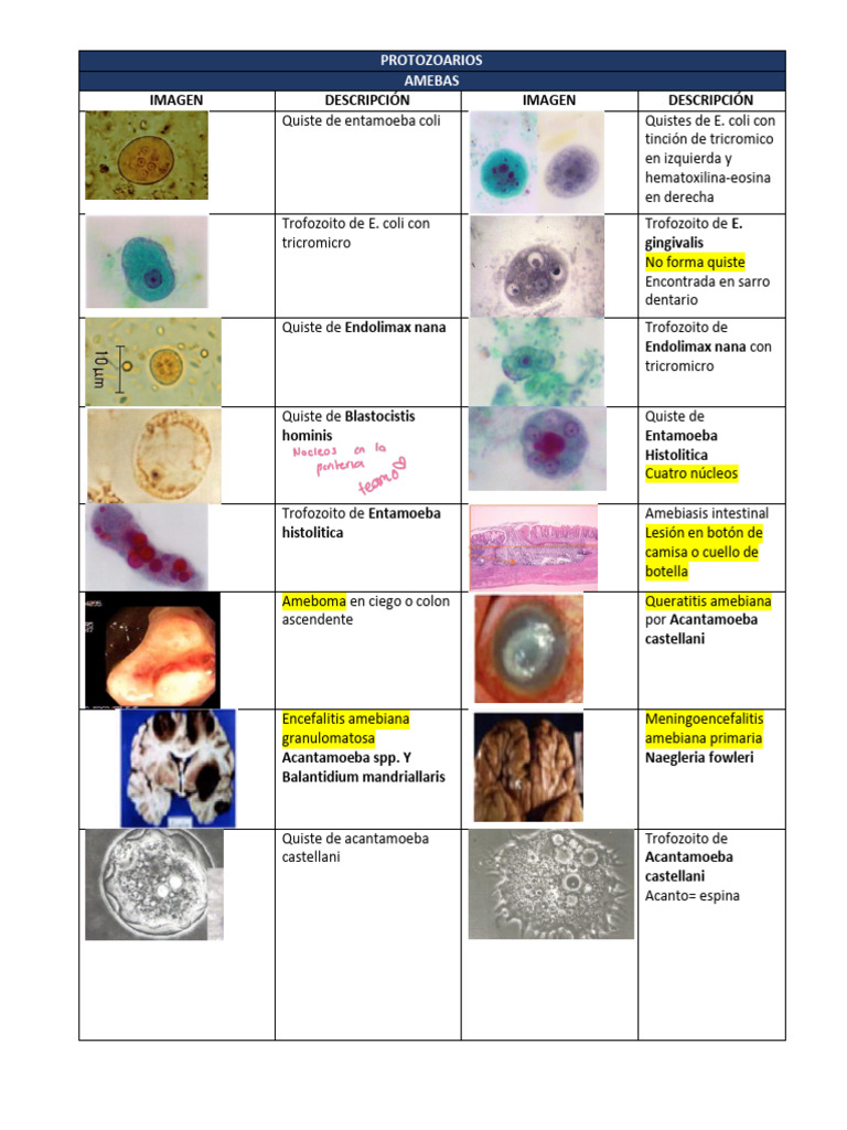 Imágenes y Descripciones de Protozoarios | PDF | Enfermedades animales ...