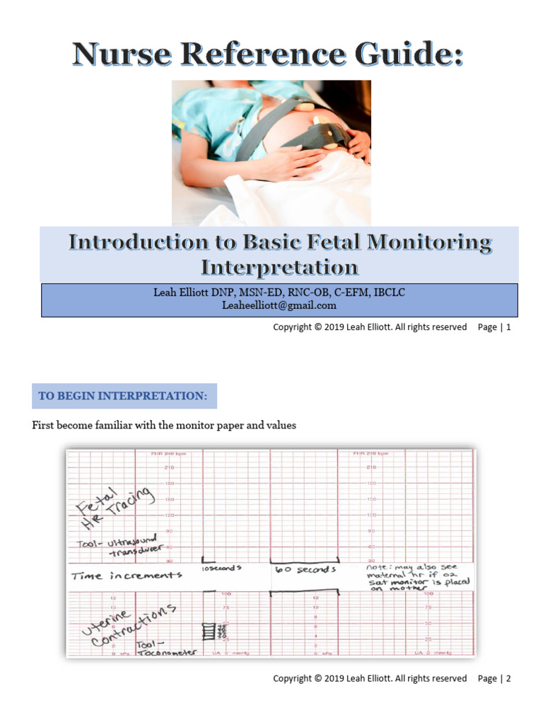 Nurse Reference Guide Fetal HR | PDF | Maternal Health | Obstetrics