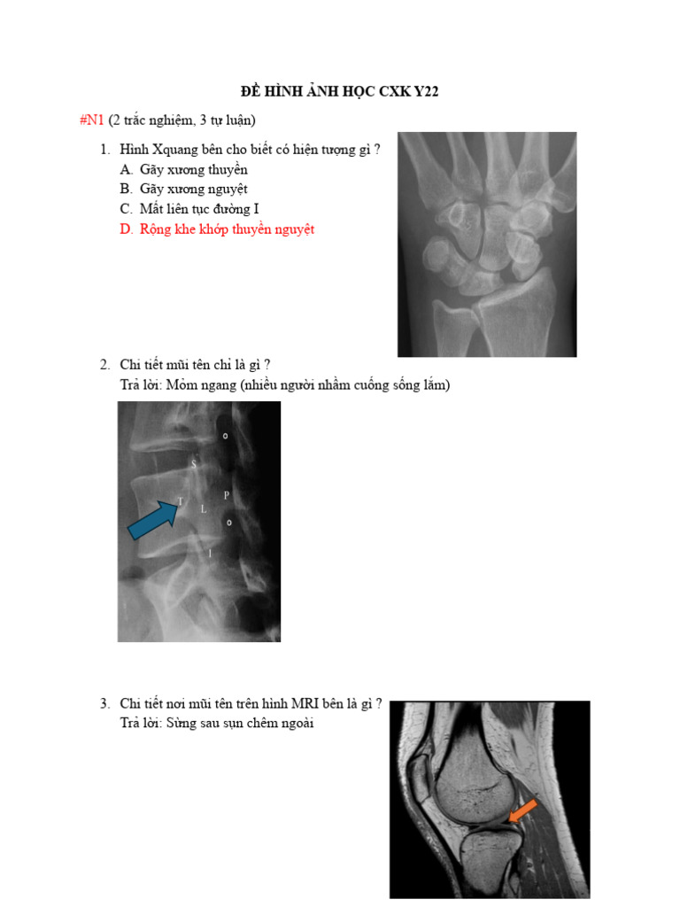 ĐỀ HÌNH ẢNH HỌC CXK Y22 | PDF