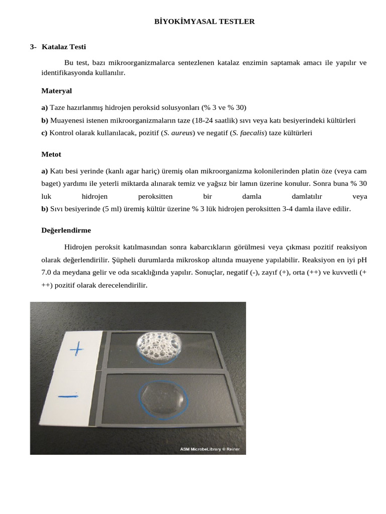 Katalaz Testi | PDF