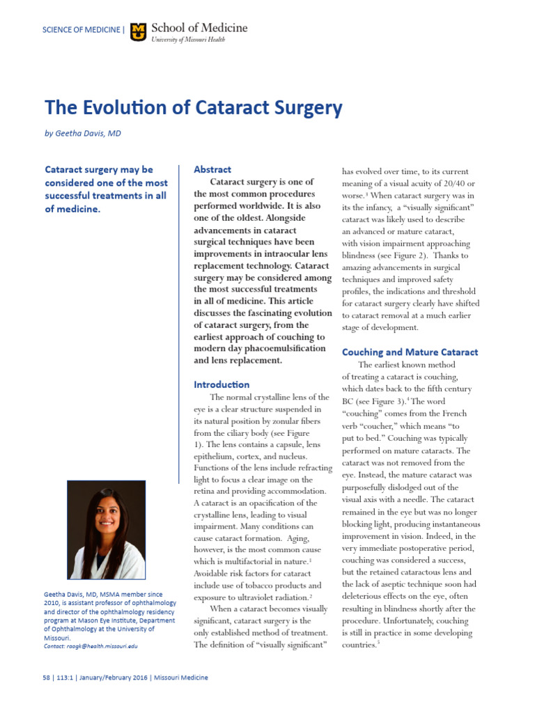 Cataract | PDF | Cataract | Surgery