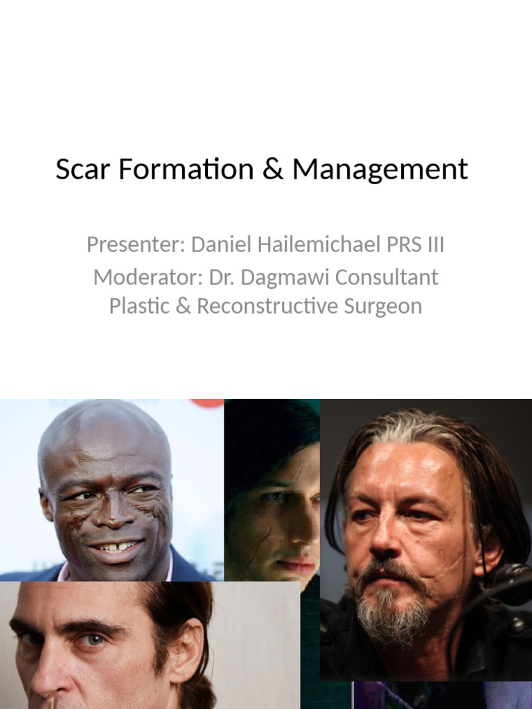 Scar Formation and Treatment Strategies | PDF | Scar | Wound Healing