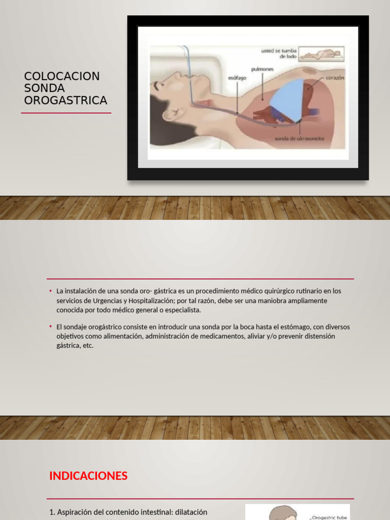 Guía Para La Colocación De Sonda Orogástrica Pdf Especialidades