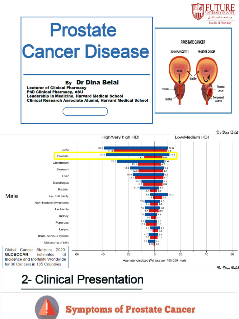 Prostate Cancer | PDF