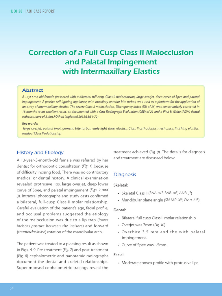 Correction of a Full Cusp Class II Malocclusion and Palatal Impingement with Intermaxillary ...