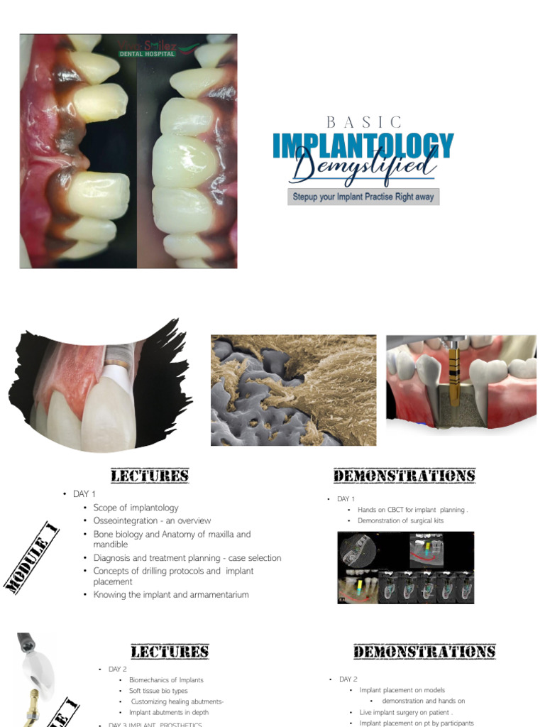 Basic implantology | PDF