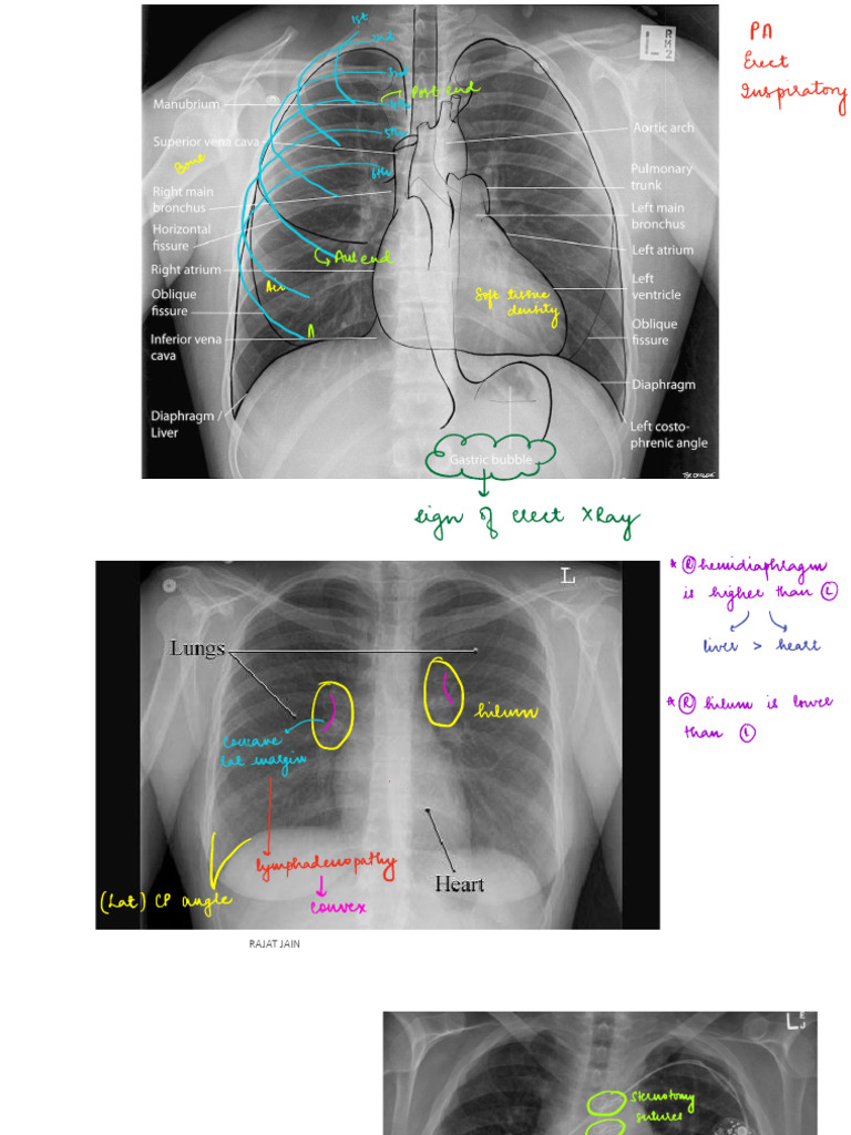 Chest, Abdomen | PDF | Thorax | Thorax (Human Anatomy)