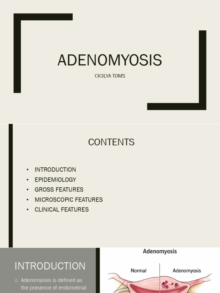 adenomyosis | PDF
