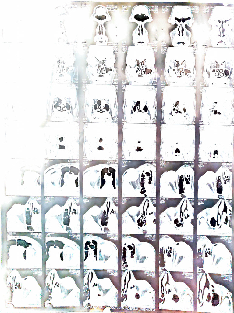 Adiseshan, 31,166 | PDF