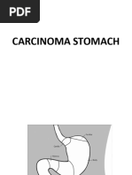 Stomach Cancer Histopathology Report | PDF | Histopathology | Pathology
