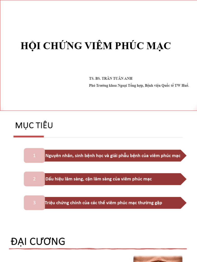 HC Viêm phúc mạc | PDF