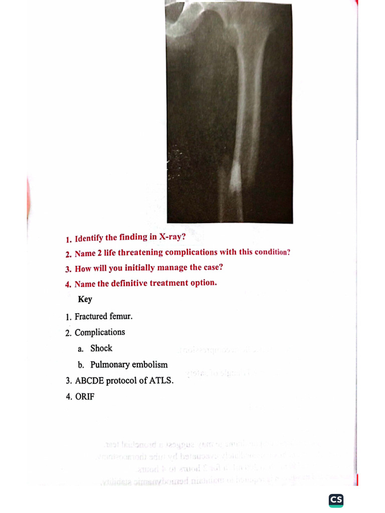 July NRE 2 Solved Papers 2024 2 | PDF