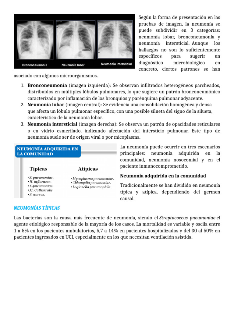 Clase de Neumonía | PDF | Neumonía | Tuberculosis