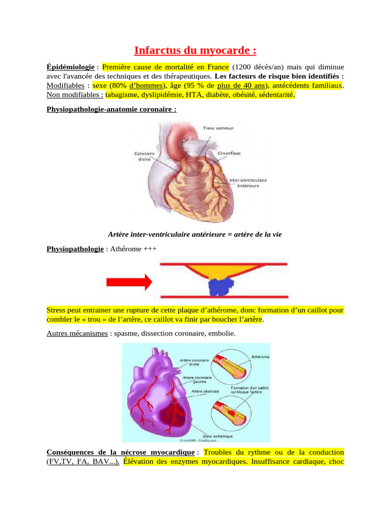 Infarctus Du Myocarde | PDF | Infarctus du myocarde | Médecine