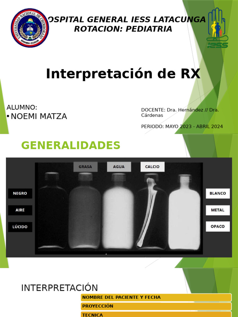 Interpretacion de RX | PDF | Pulmón | Tórax