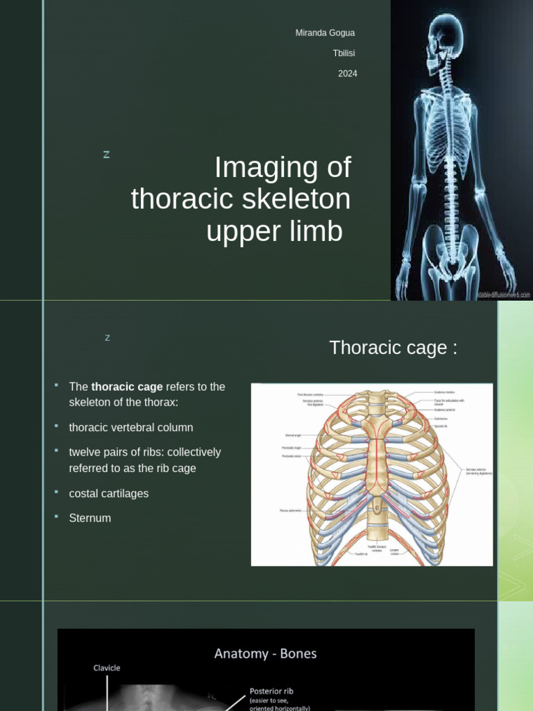 Thoracic Skeleton Imaging Techniques | PDF | Thorax | Musculoskeletal ...