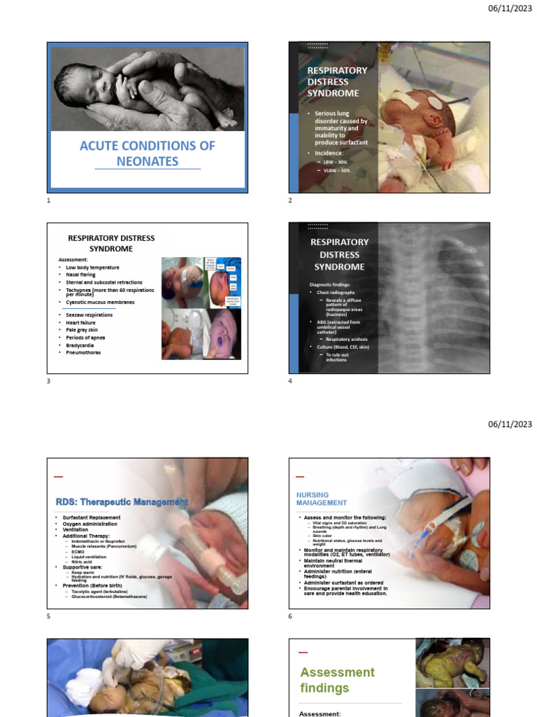 Neonatal Acute Conditions Overview | PDF | Clinical Medicine | Medical ...